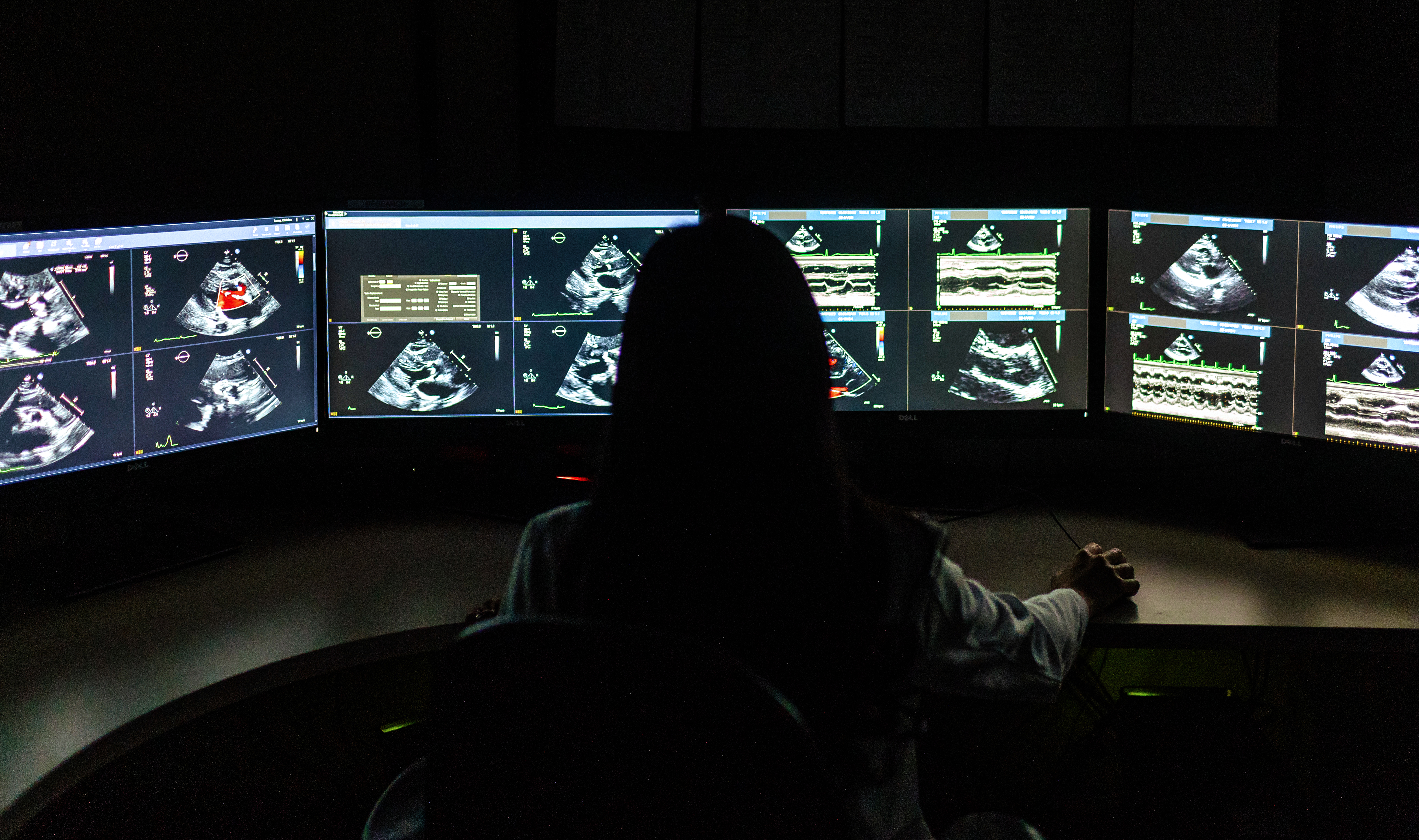 Machine learning for handheld cardiac ultrasounds | VCH Research Institute