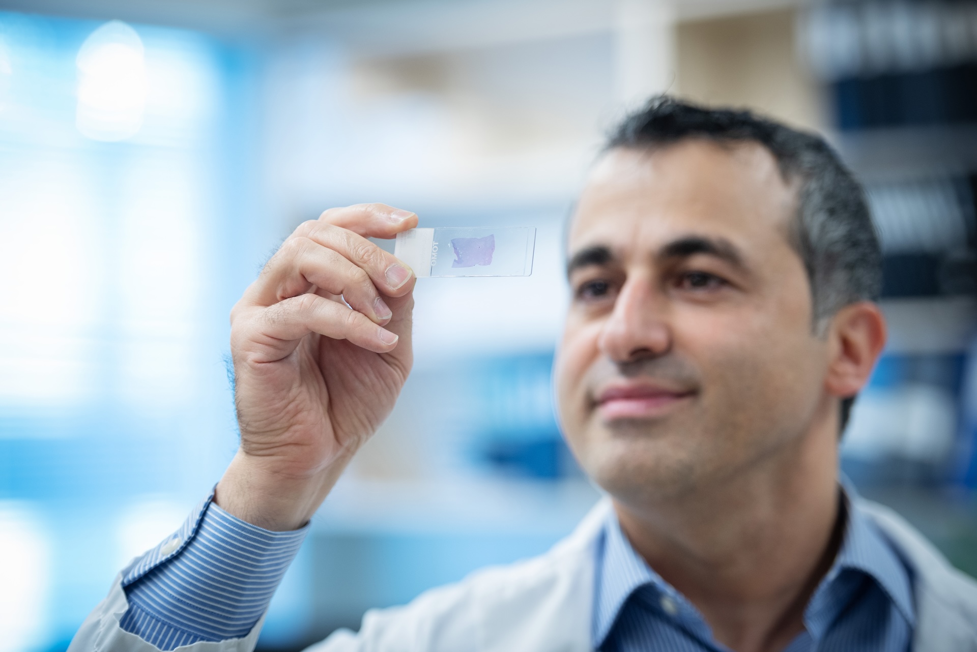 Scientists discover high-risk form of endometrial cancer — and how to ...